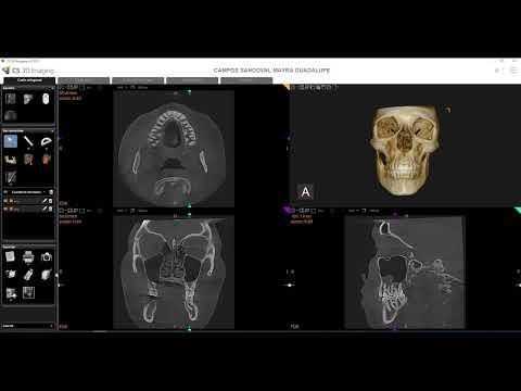 4. Cortes Axiales | DRG Dental Radiology Group